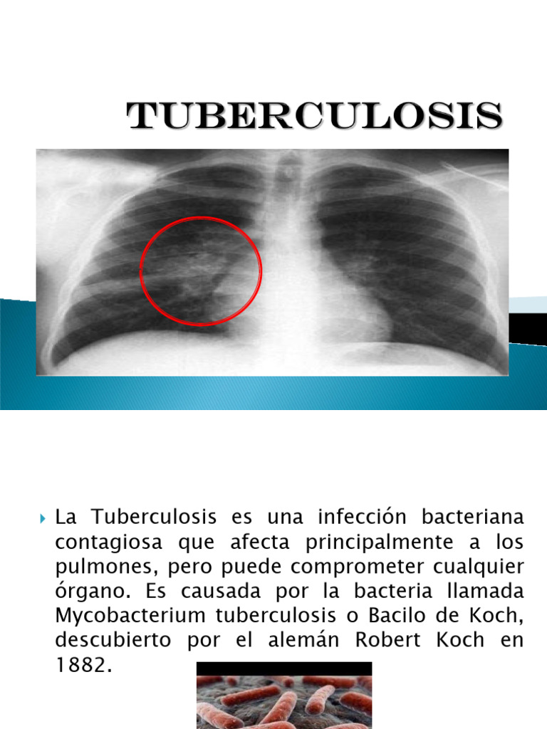 16ava CLASE CUIDADOS DE ENFERMERIA EN APS ADULTO PREVENCION Y ...