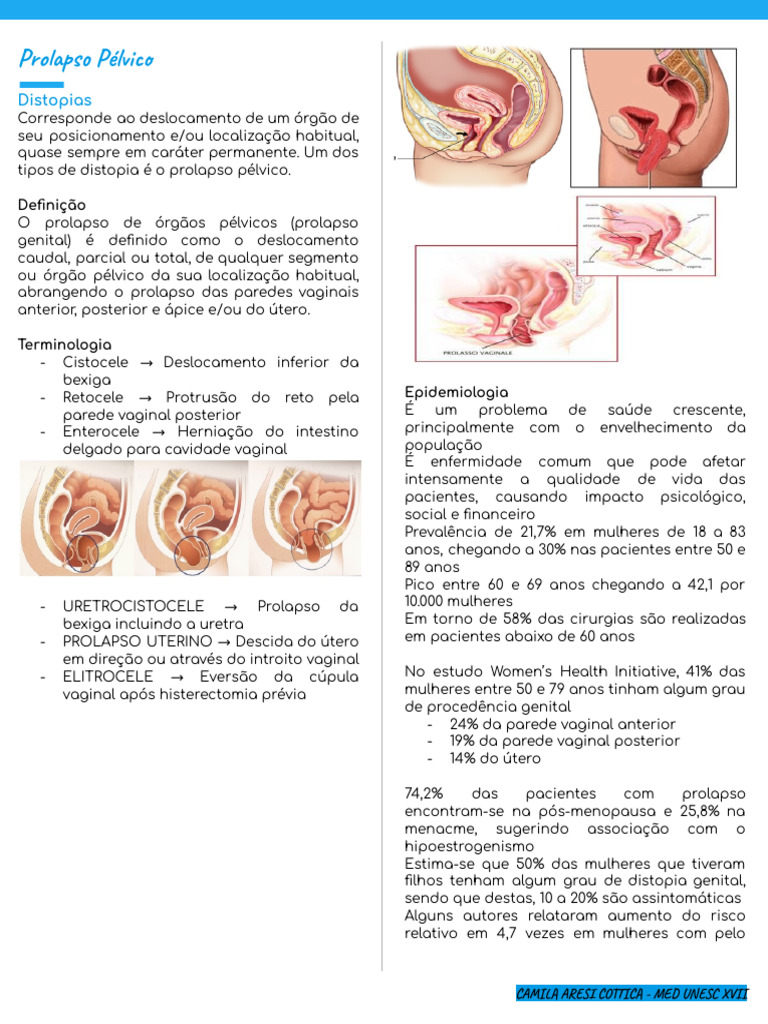 Prolapso PÃ©lvico - Dr. Charles Binda | PDF | Vagina | Pélvis