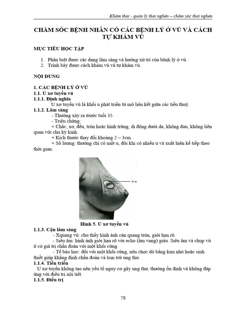 Khám vú | PDF