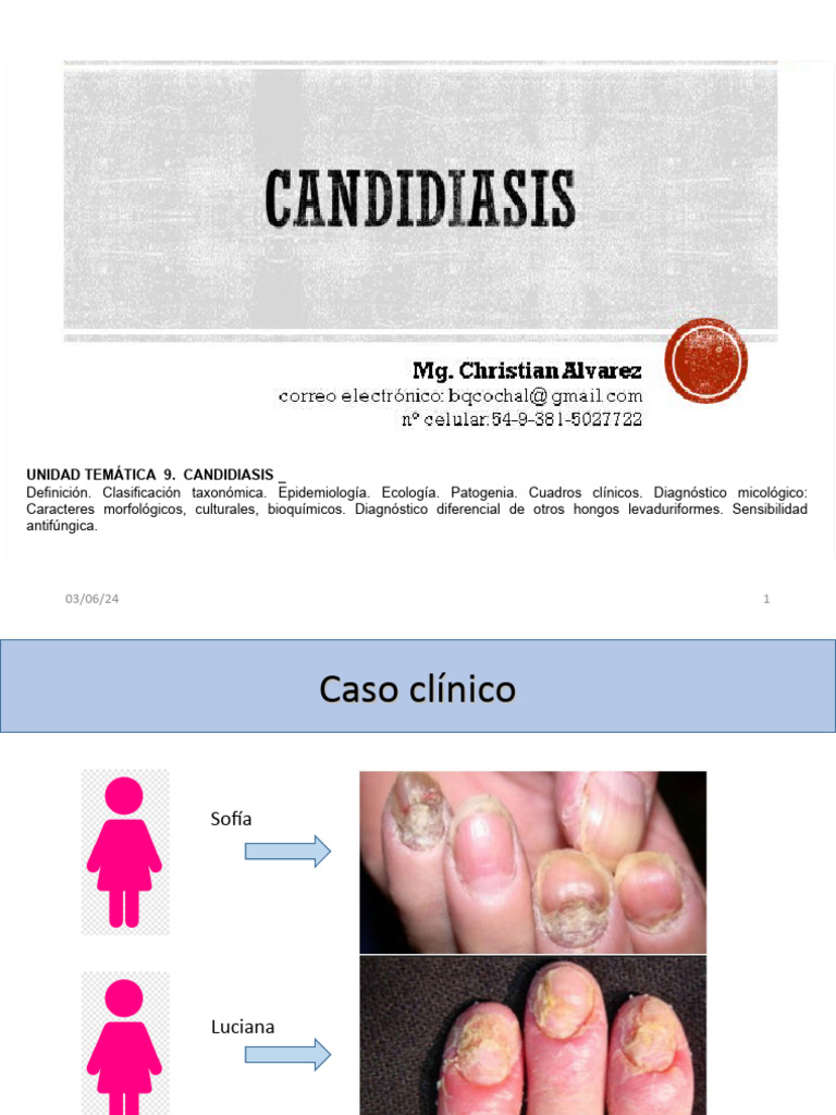 Diagnóstico y Tratamiento de Candidiasis | PDF | Candidiasis | Candida (hongo)