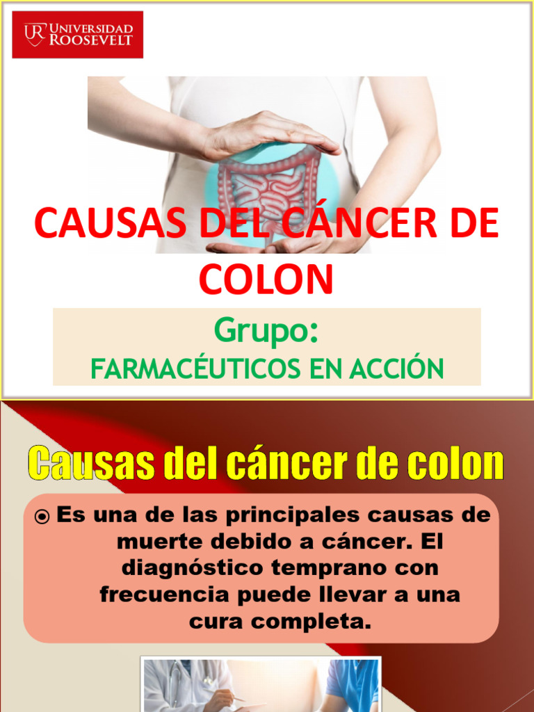 Rotafolio Causas Del Cáncer de Colon | PDF