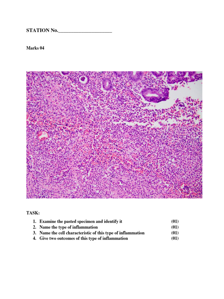 3rd Pathology Ospe PDF | PDF | Inflammation | Cancer