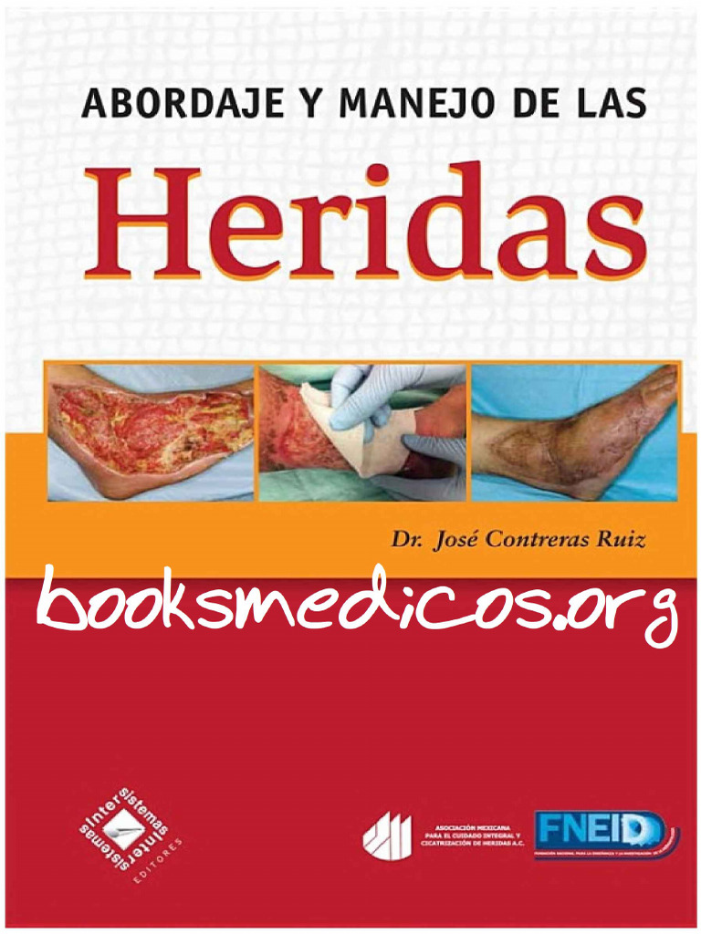 Abordaje y Manejo de Las Heridas | PDF