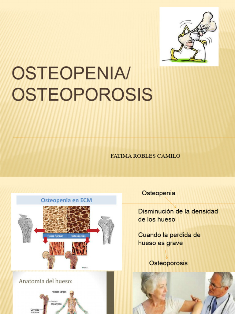 Osteopenia | Descargar gratis PDF | Osteoporosis | Alimentos