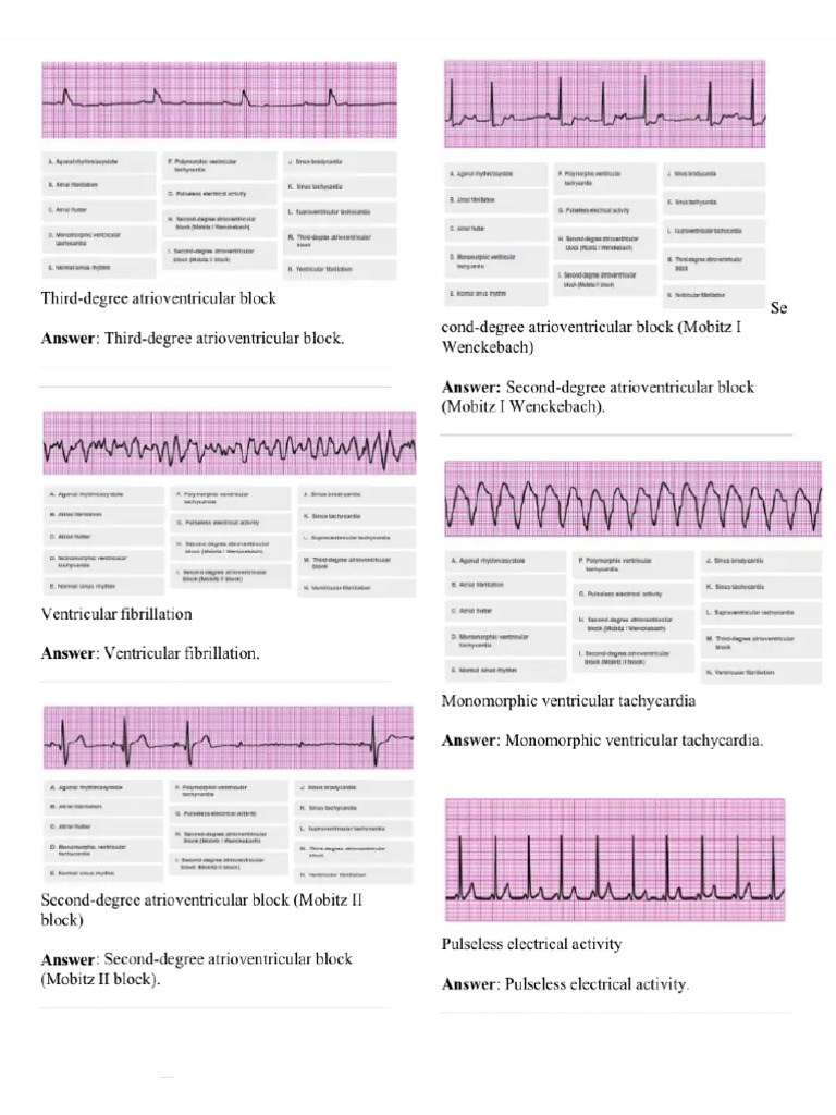 ACLS Pre Test Answers3 | PDF