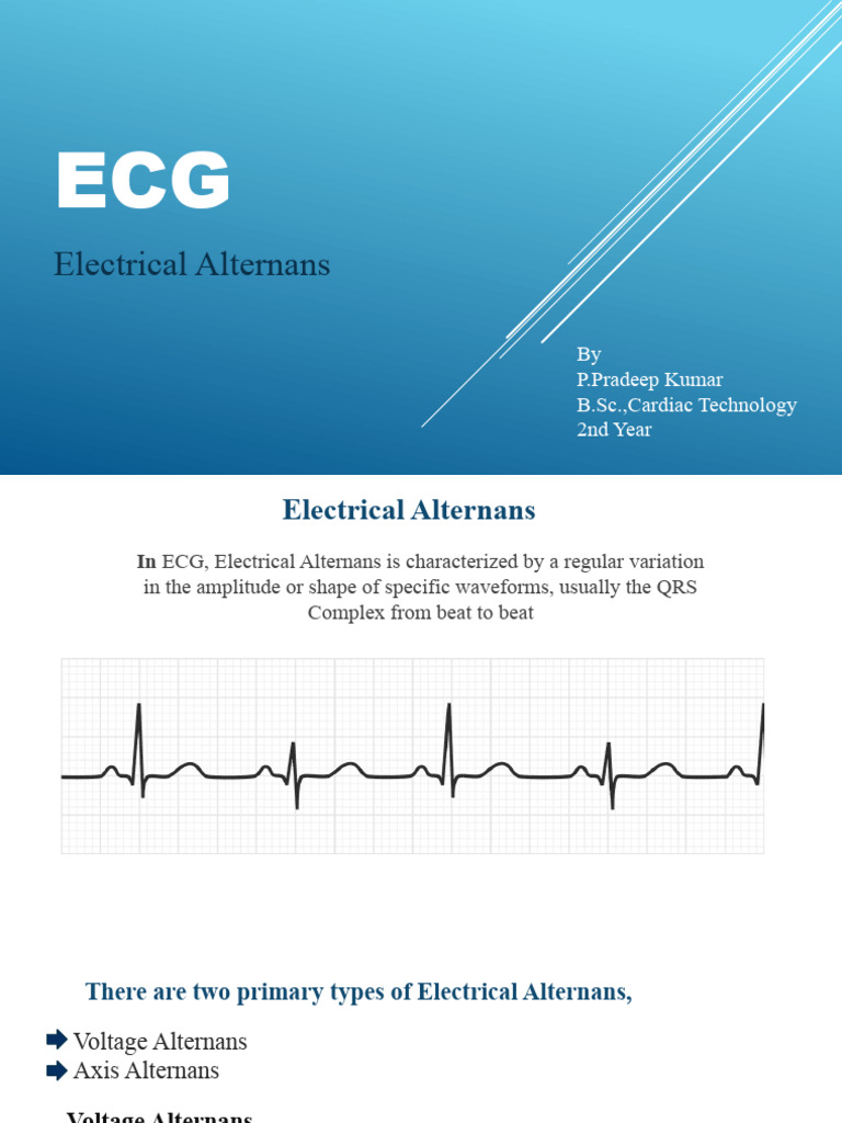 ECG-Electrical Alternans | PDF
