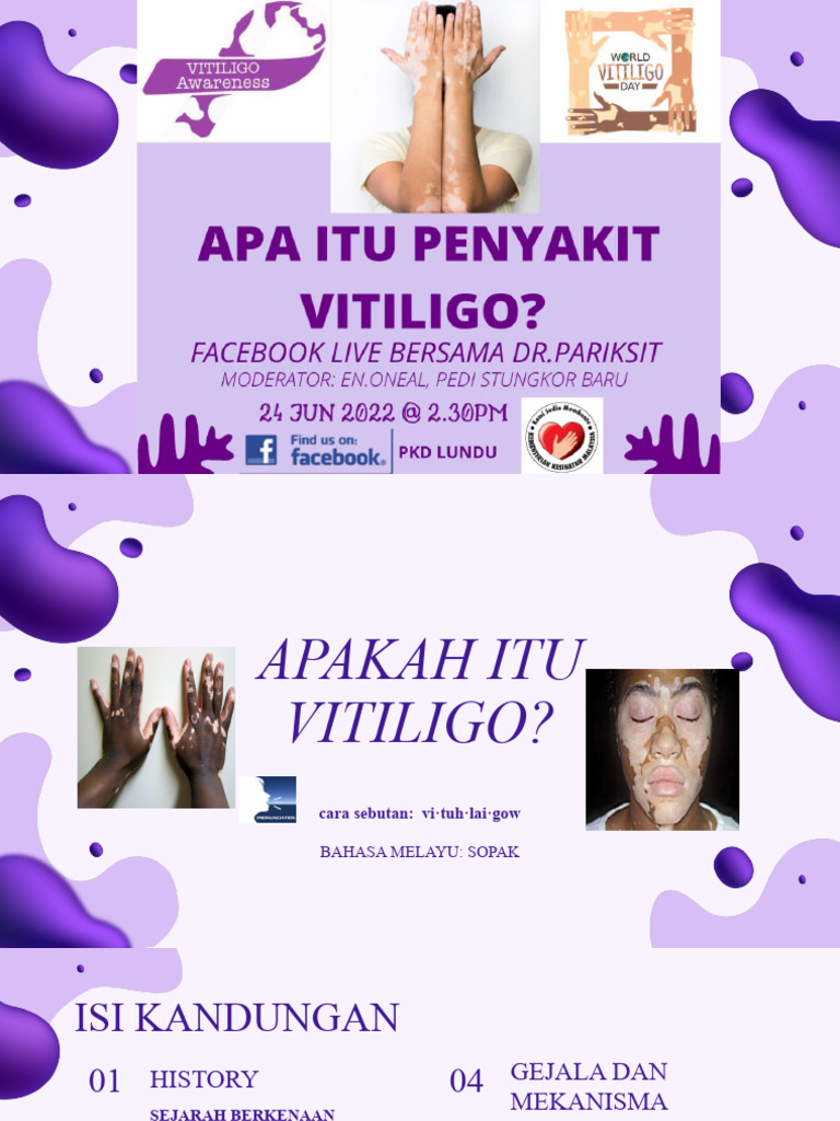 VITILIGO With Attendance | PDF | Skin | Dermatology