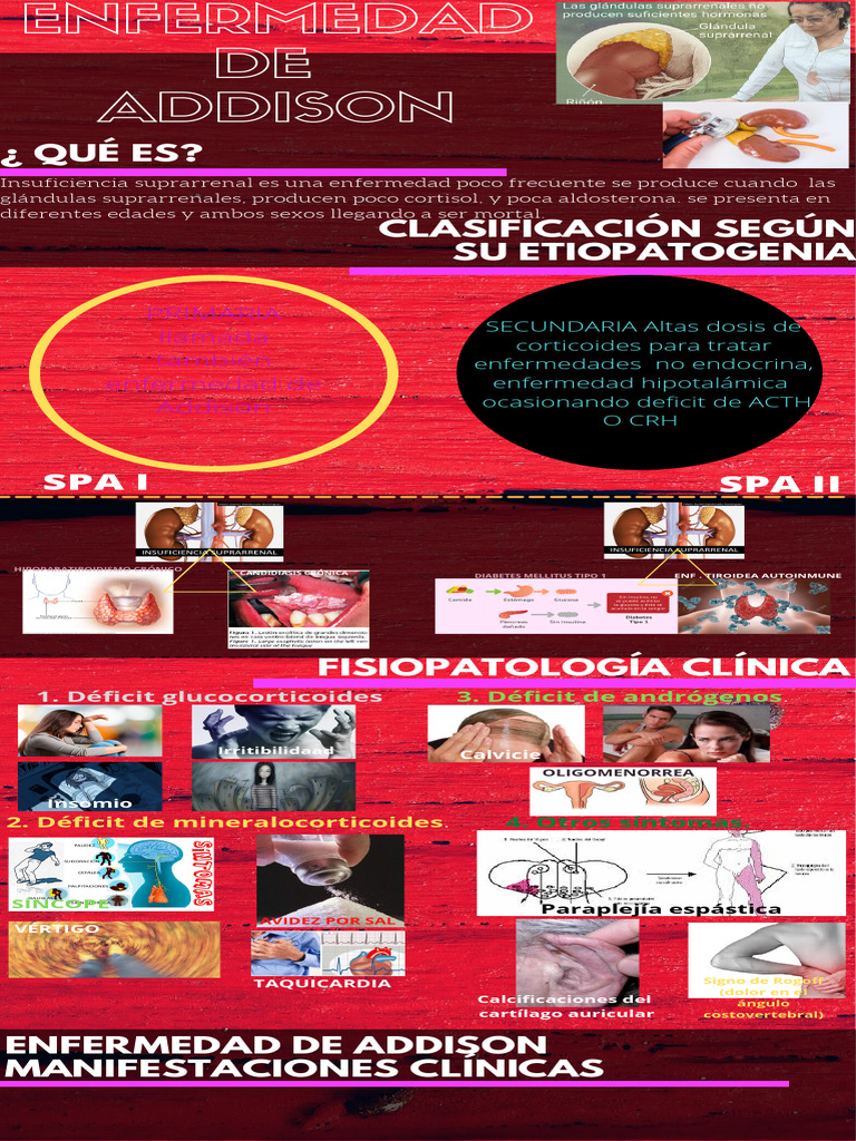 ENFERMEDAD DE ADDISON | PDF | Glándula suprarrenal | Enfermedades y trastornos humanos