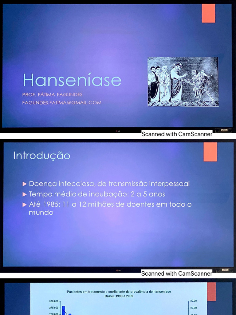 Infectologia - Slide de Hanseníase | PDF