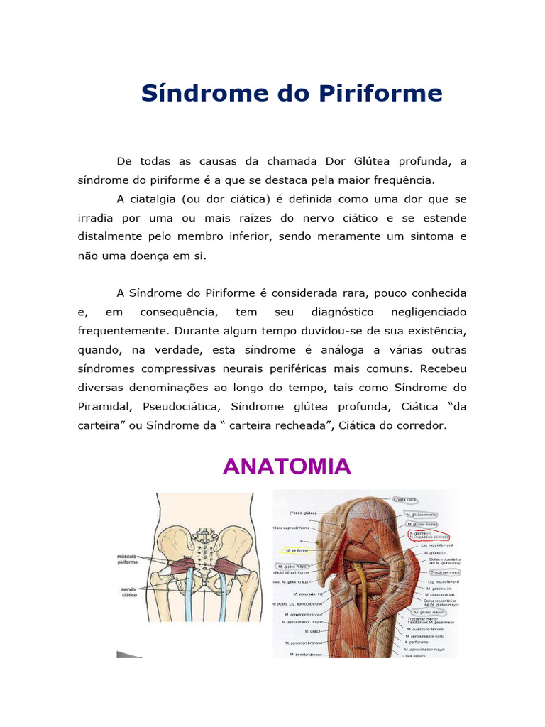 sindrome-piriforme | PDF | Doenças e distúrbios | Medicina Clínica