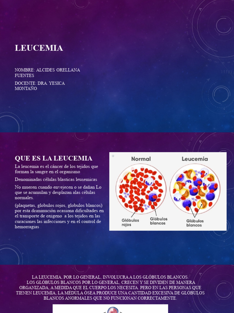 Comprendiendo la Leucemia: Tipos y Síntomas | PDF | Leucemia | Sangre