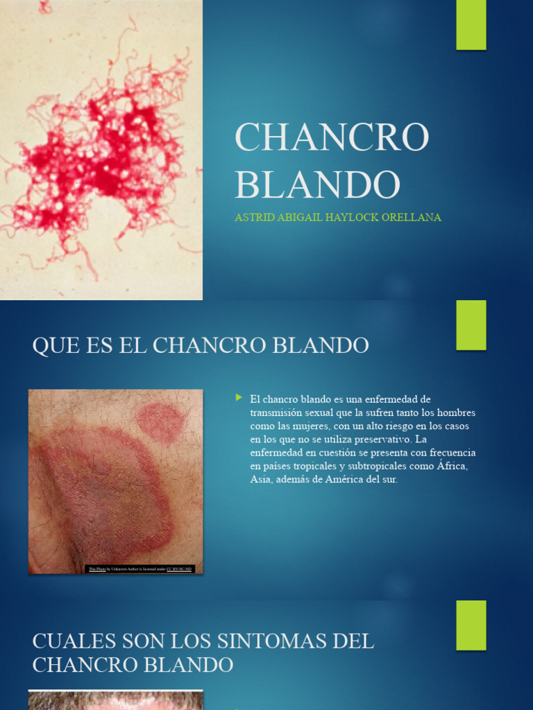 Chancro Blando | PDF | Infección transmitida sexualmente | Inmunología