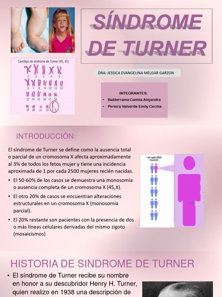 Sindrome de Turner | PDF | Especialidades Medicas | Medicina CLINICA