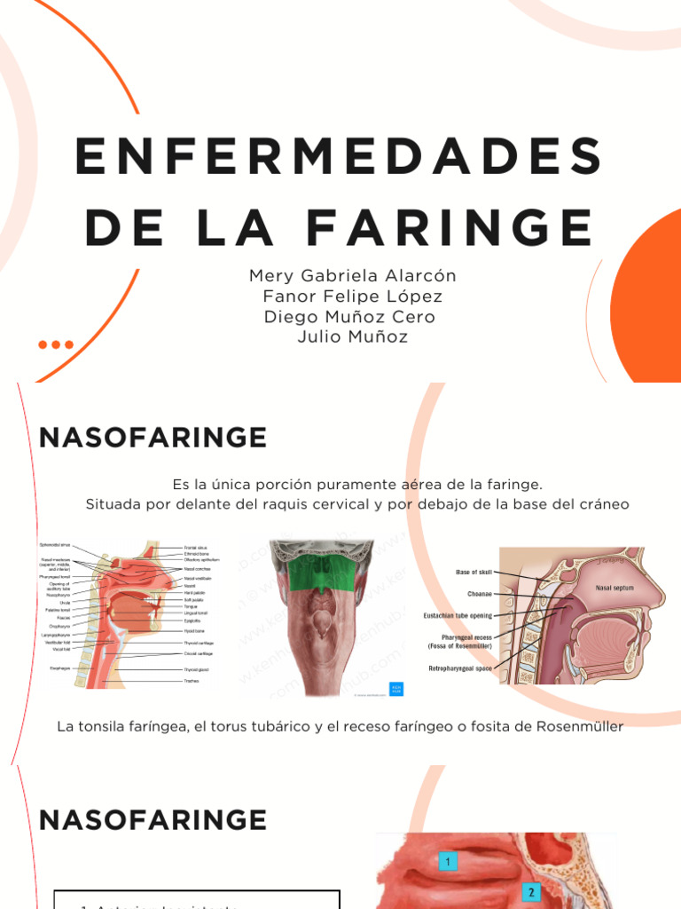 Enfermedades de La Faringe | PDF | Cáncer | Neoplasias