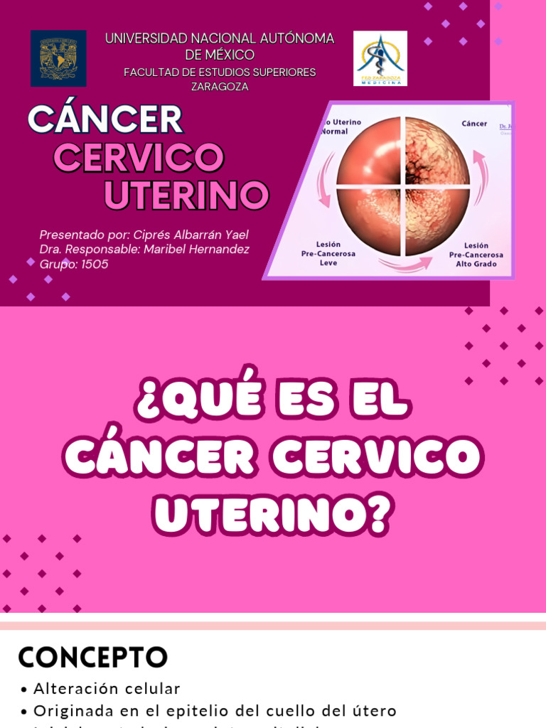 Cáncer Cérvico Uterino: Diagnóstico y Prevención | PDF | Cáncer de ...