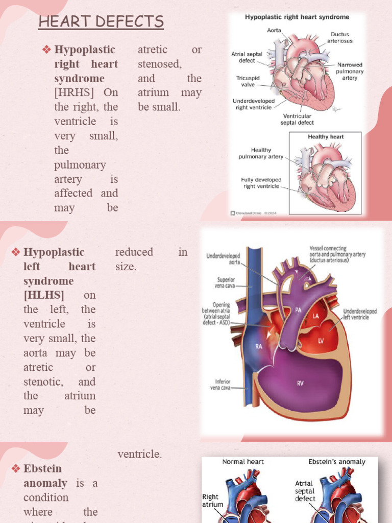 Types of Heart Defects Explained | PDF | Science & Mathematics