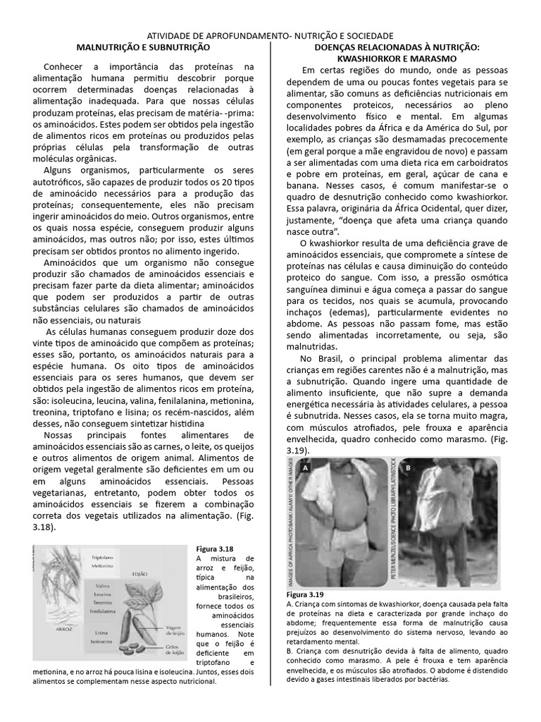 Aprofundamento 1 Malnutrição e Subnutrição Guia de Leitura | PDF ...