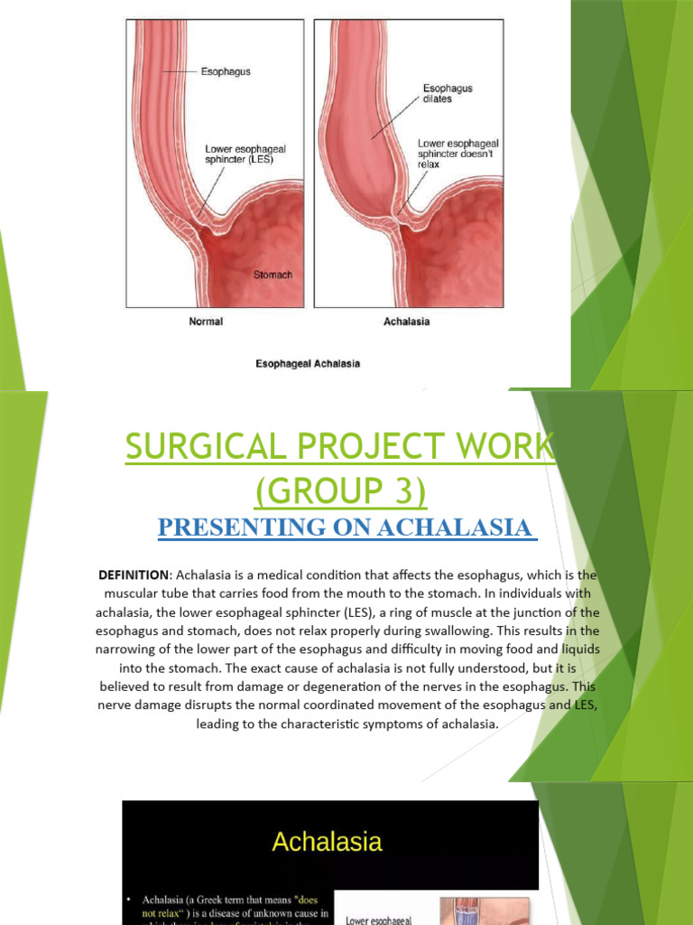 SURGICAL PROJECT WORK (GROUP 3) PPTX (Recovered) | PDF | Esophagus ...
