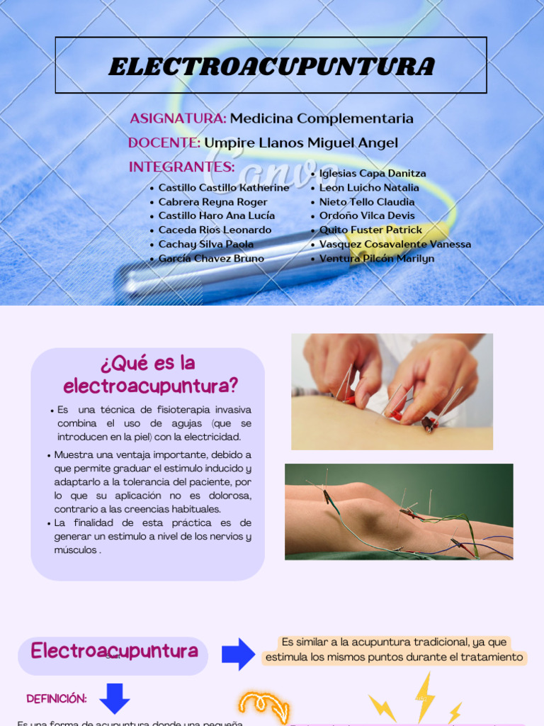 Electro a Cup Un Tura | PDF | Cerebro | Dolor