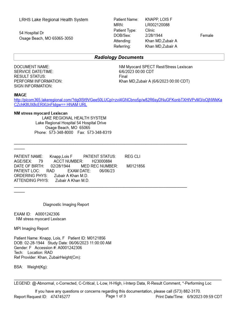 NM Myocard SPECT Rest-Stress Lexiscan 06-06-2023 | PDF | Clinical ...