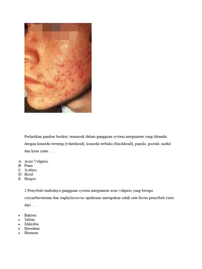 Soal Ippd Kelas Xii | PDF