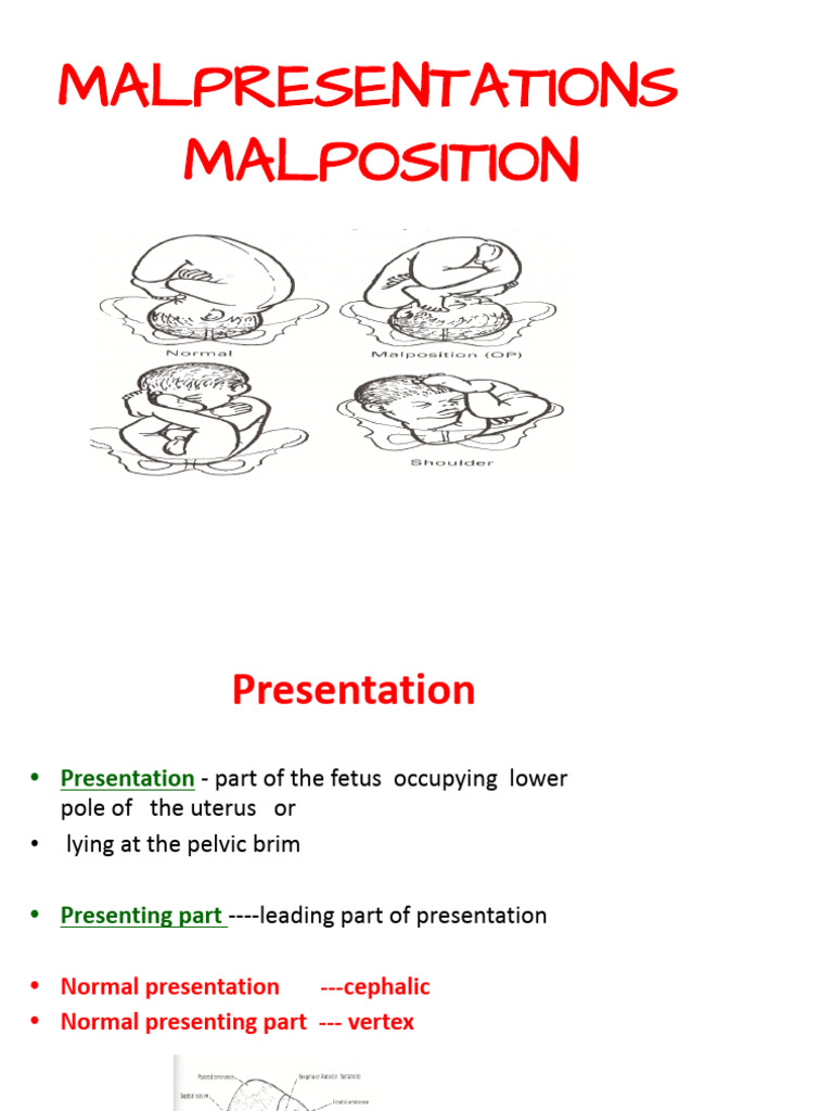 Fetal Malpositions and Malpresentations | PDF | Childbirth | Pelvis
