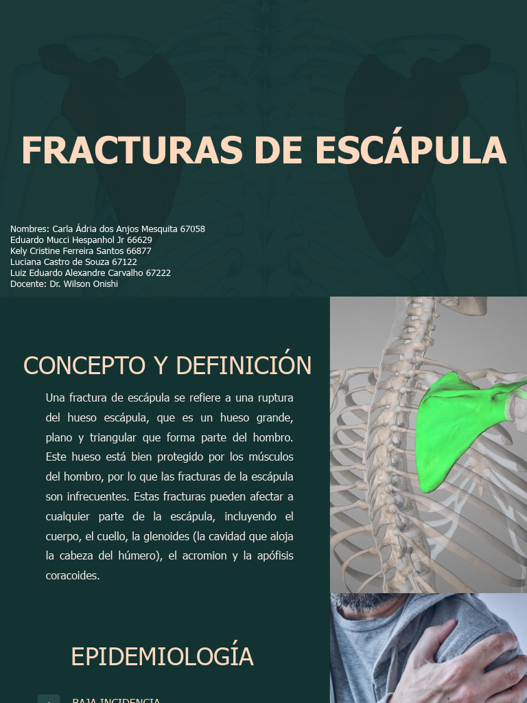 Clasificación y tratamiento de fracturas de escápula | PDF | Hombro ...