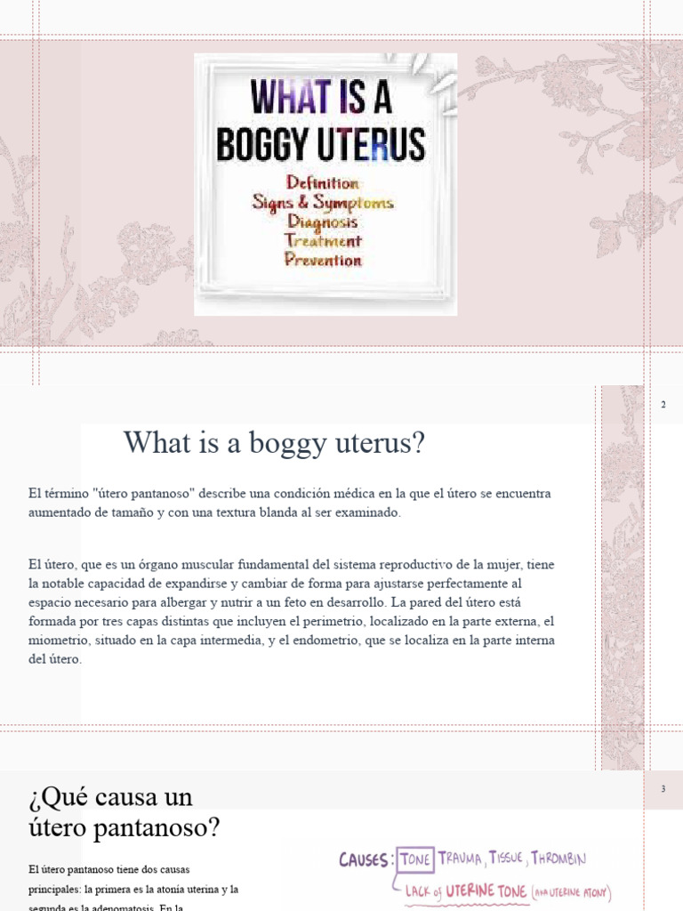 boggy fundus (1) | PDF | El embarazo | Útero