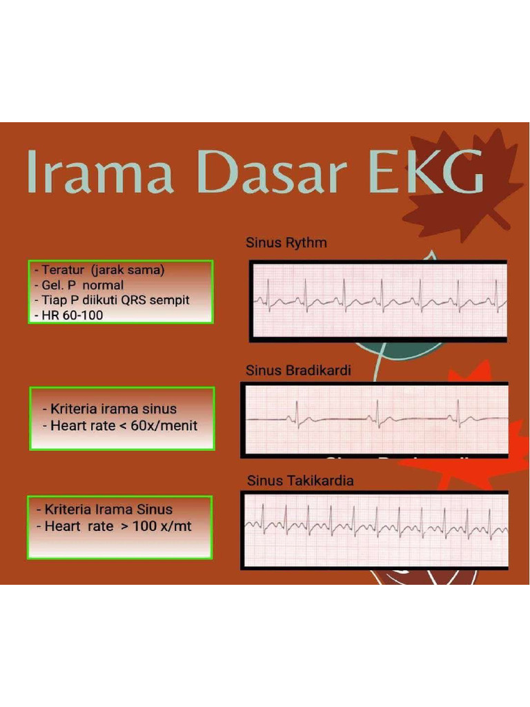 Gambaran Ekg 2 | PDF
