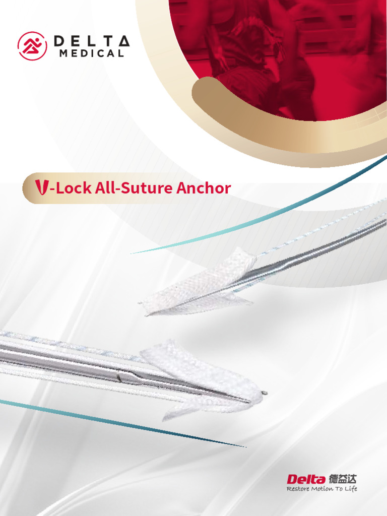 V-Lock All-Suture Anchor Overview | PDF | Surgical Suture | Screw