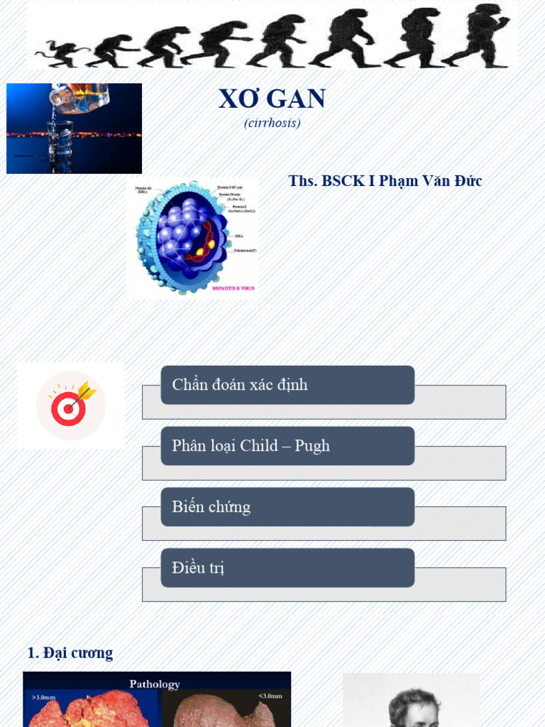Xơ Gan | PDF