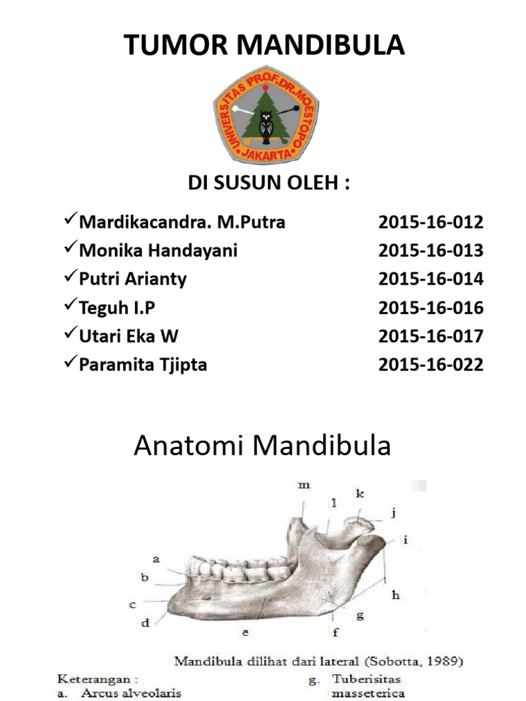 Tumor Mandibula Klinik Umum | PDF | Kesehatan Holistik | Sains & Matematika
