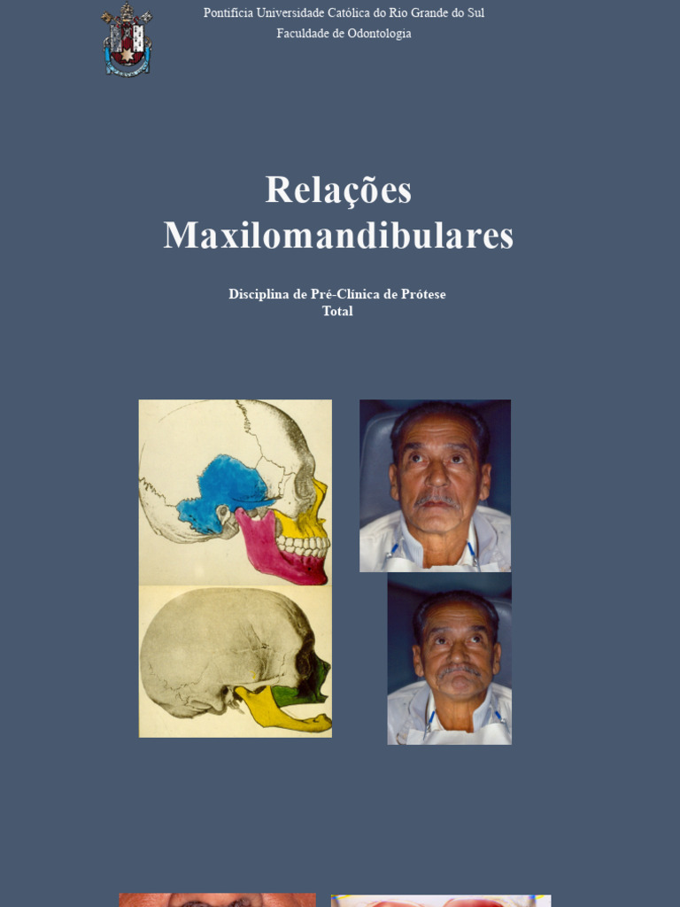 Relações Maxilo-Mandibulares | PDF