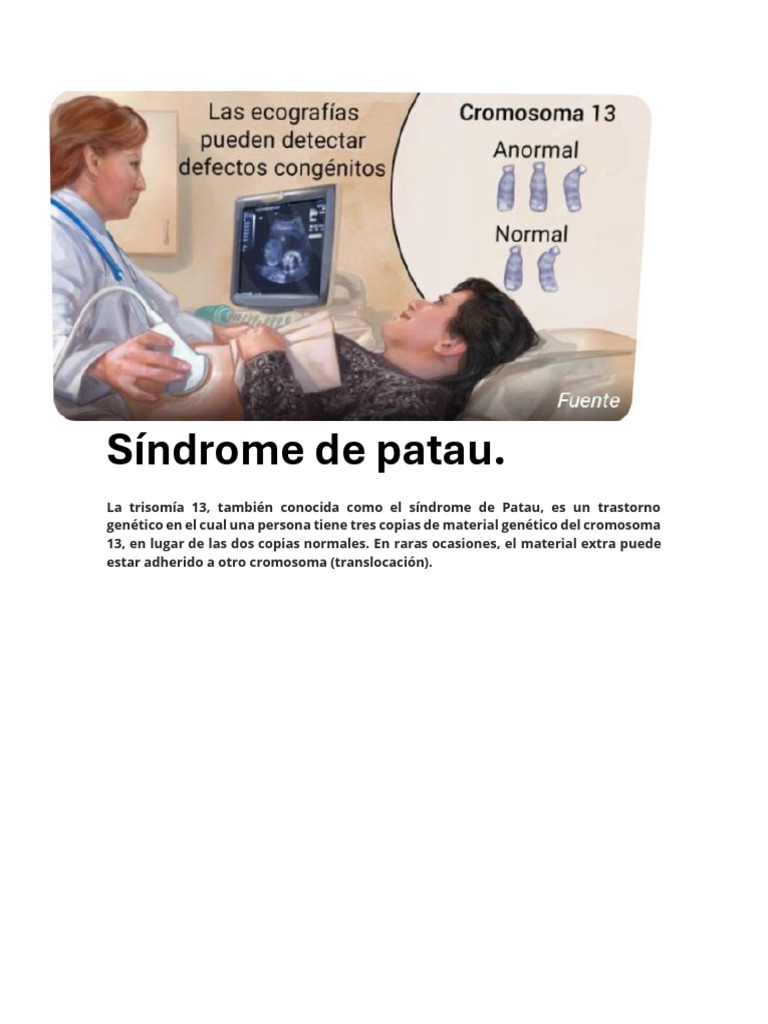 Síndrome de Patáu. | PDF | Corazón | Causas de la muerte