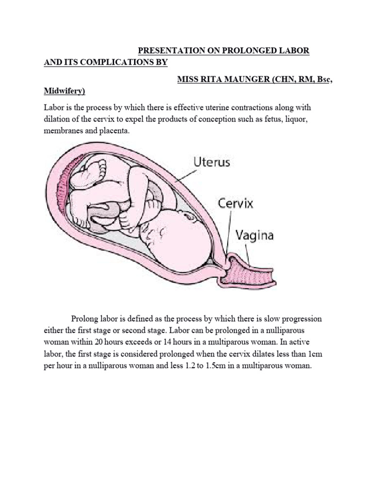 Prolonged Labor: Causes and Management | PDF | Technology & Engineering