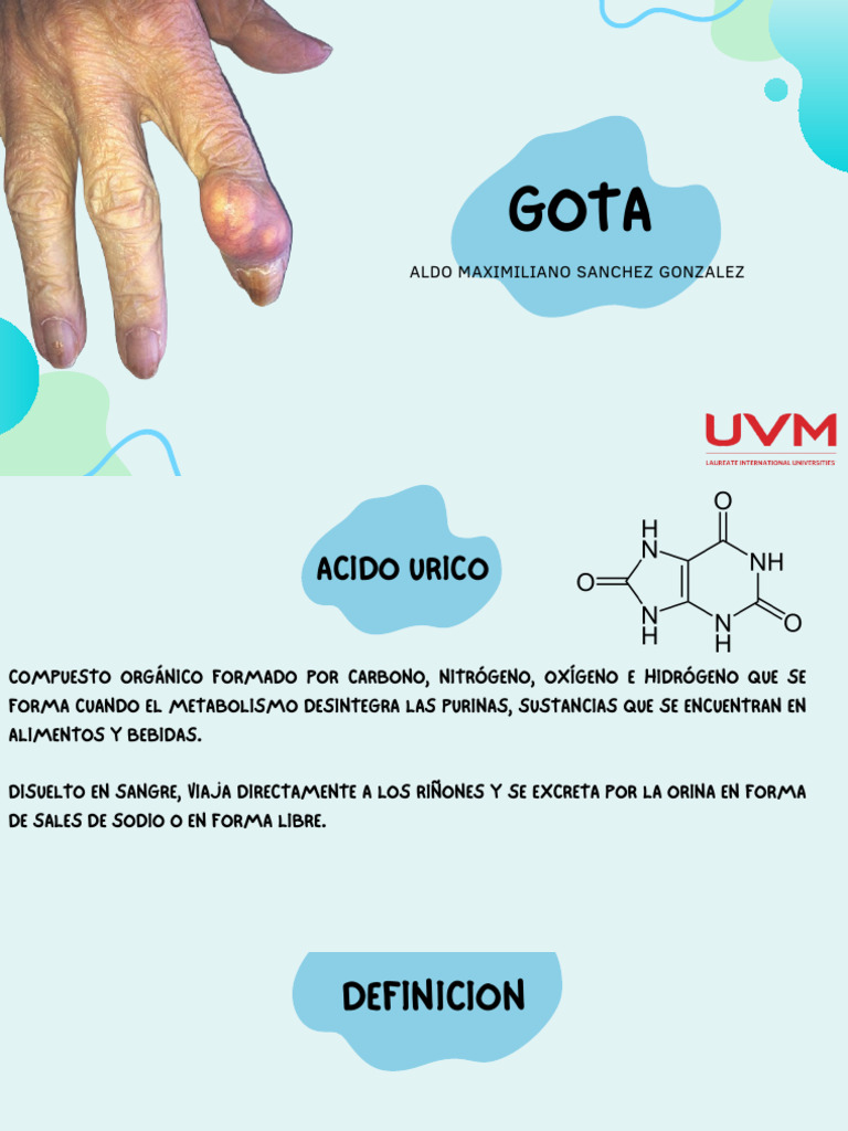 Gota | PDF | Gota | Enfermedades y trastornos