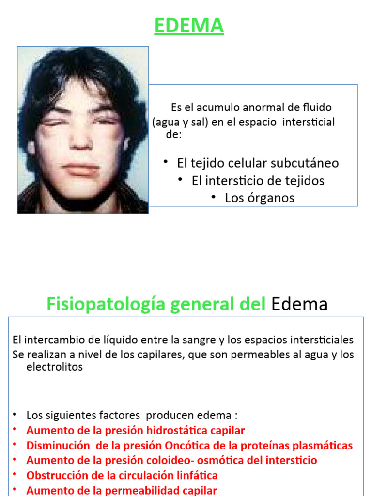 Edema | PDF | Edema | Fisiología