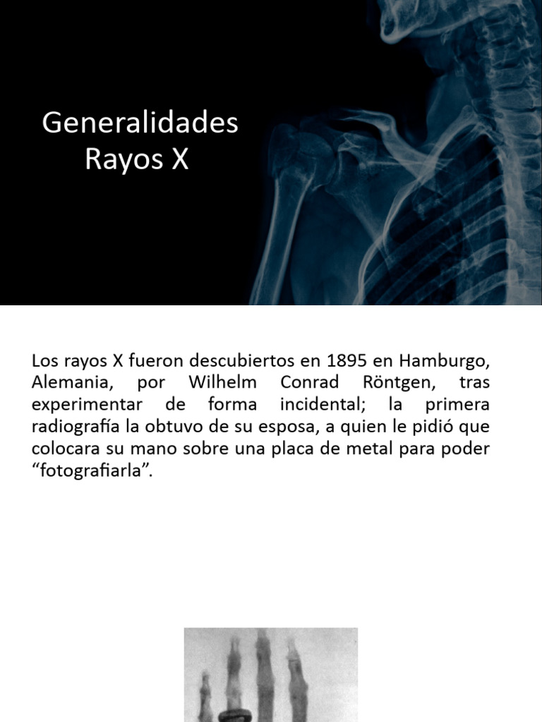 Generalidades sobre Rayos X y Radiología | PDF