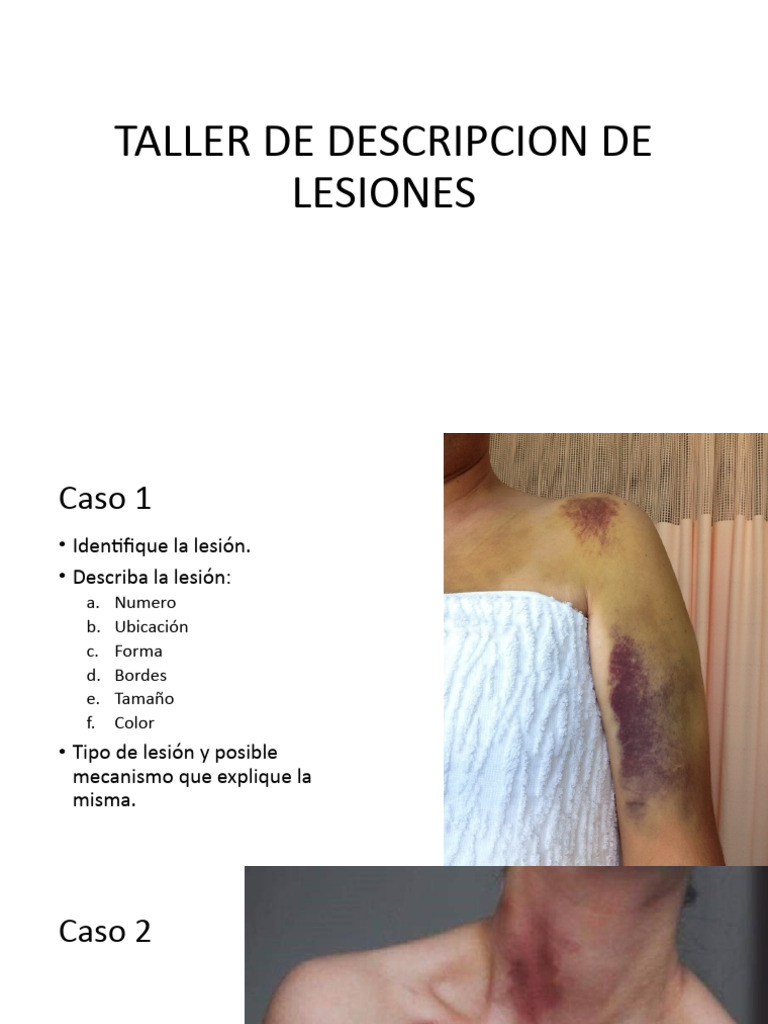 Taller de Descripcion de Lesiones | PDF