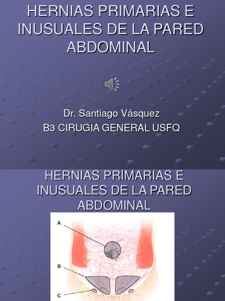 4. 2 HERNIAS PRIMARIAS E INUSUALES DE LA PARED ABDOMINAL | Descargar gratis PDF | Abdomen ...