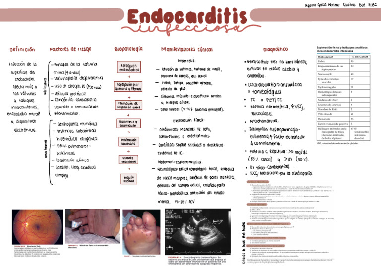 Endocarditis | PDF | Sistema cardiovascular | Enfermedades cardiovasculares