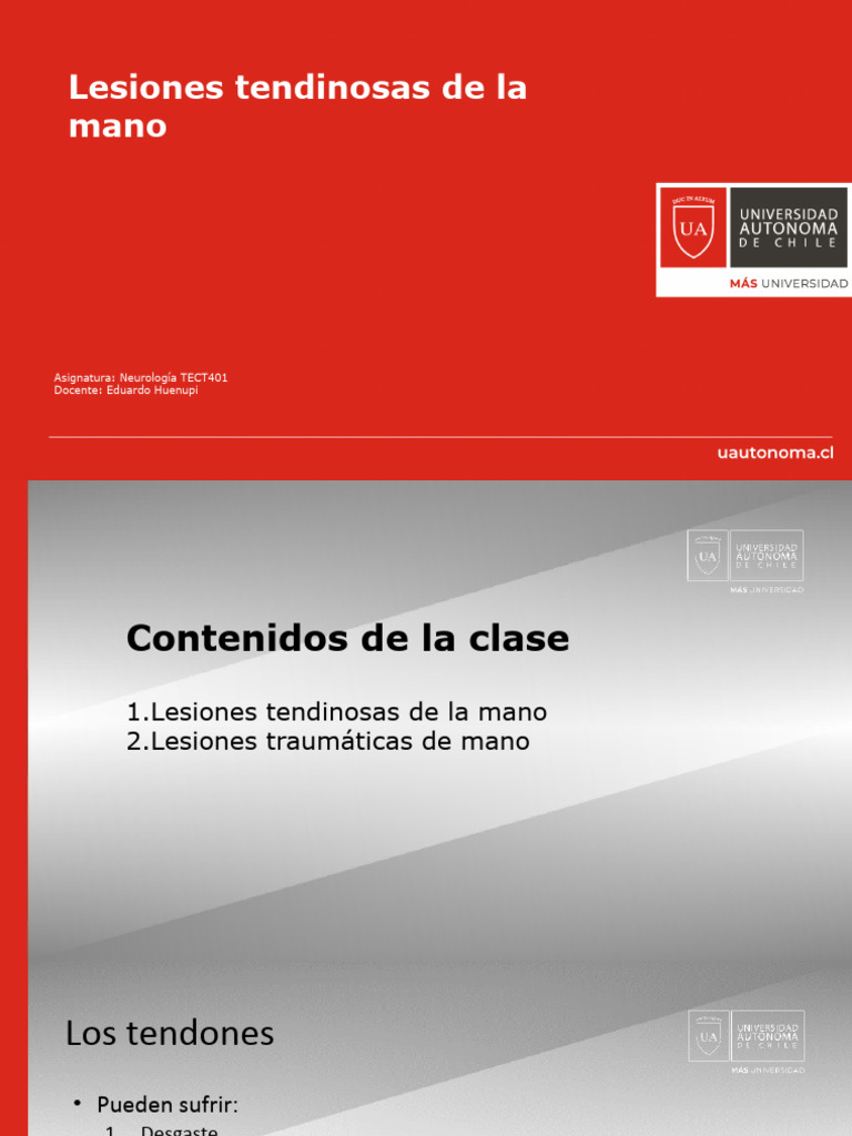 Clase N 8 Traumatologia (1) | Descargar gratis PDF | Mano | Tendón