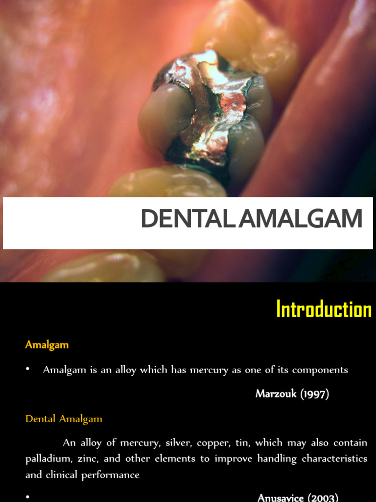 Dental Amalgam | PDF | Mercury (Element) | Metallic Elements