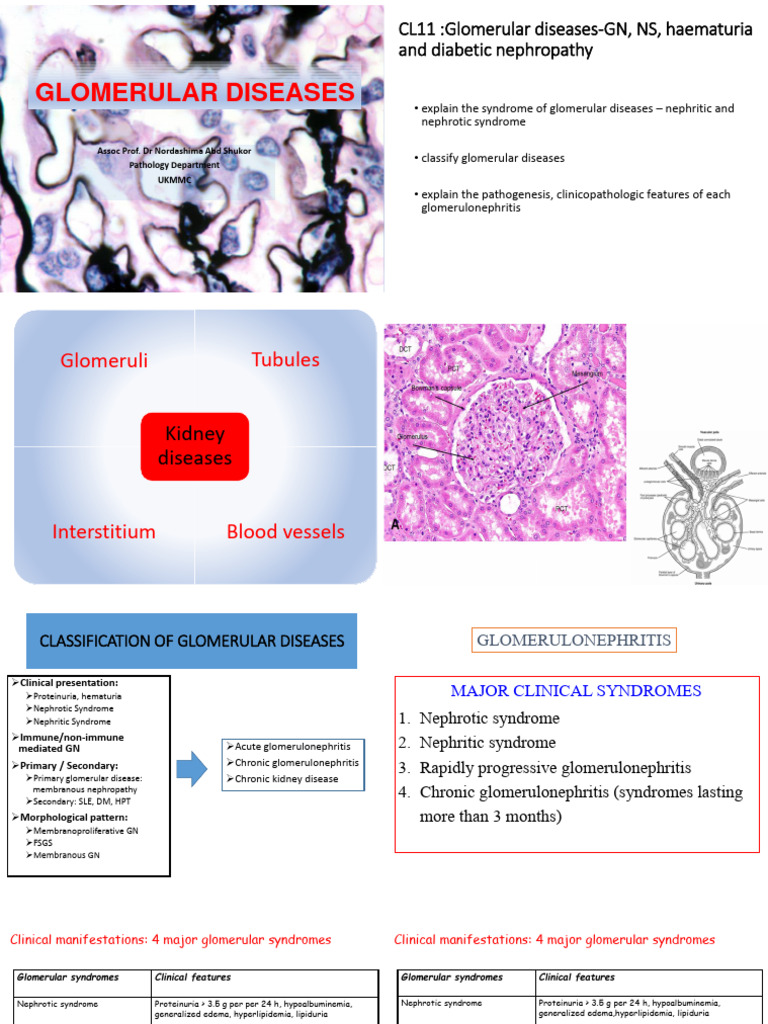 CL10 Glomerular Diseases | PDF | Diseases And Disorders | Urological ...