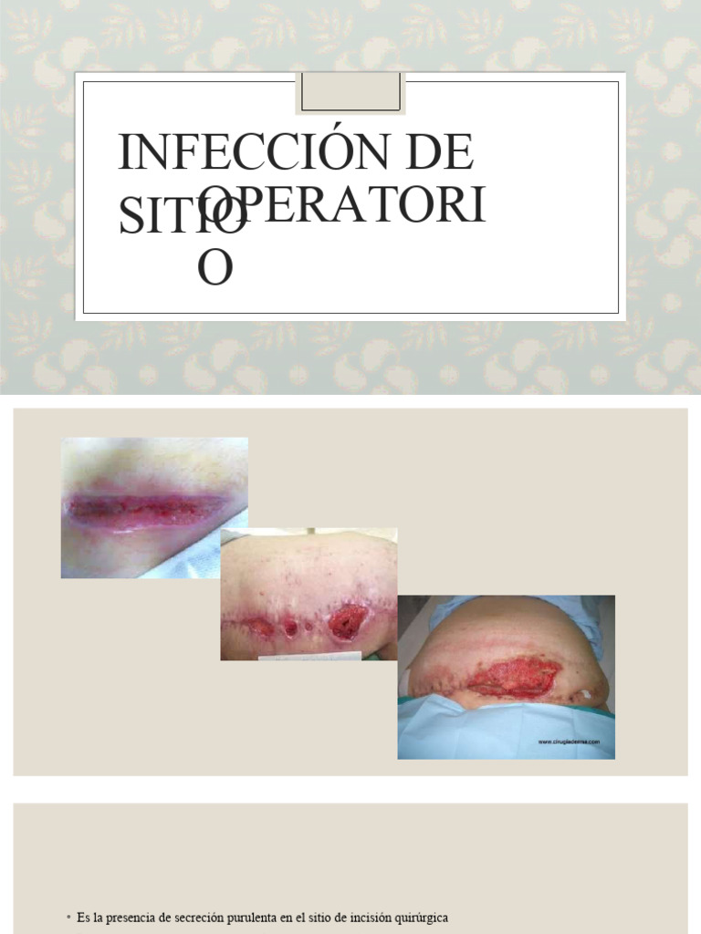 Infeccion Del Sitio Quirurgico | PDF | Staphylococcus Aureus | Cirugía