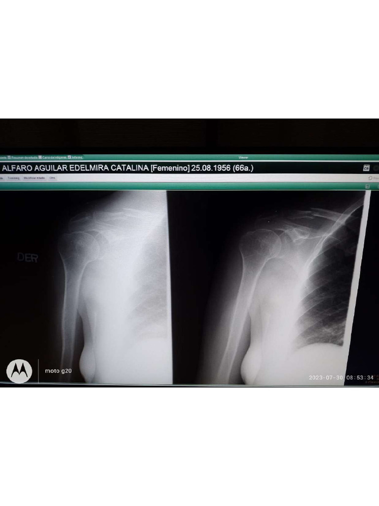 Radiografia 1-Mama | PDF