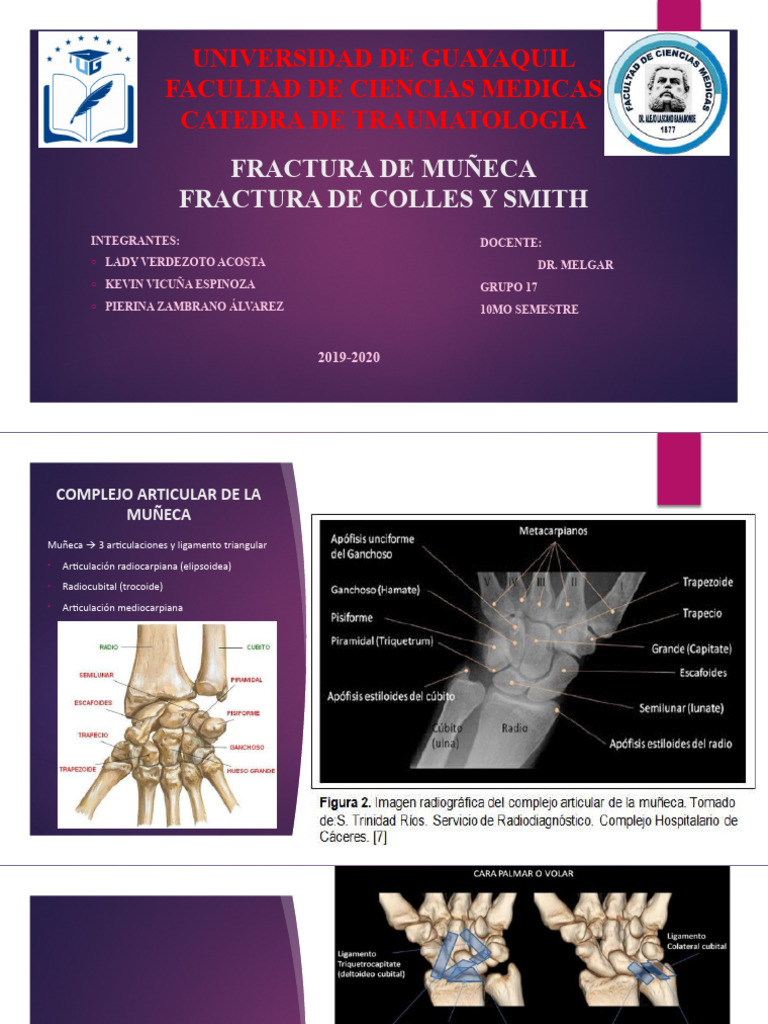 Fracturas de Muñeca: Colles y Smith | PDF | Anatomía humana ...
