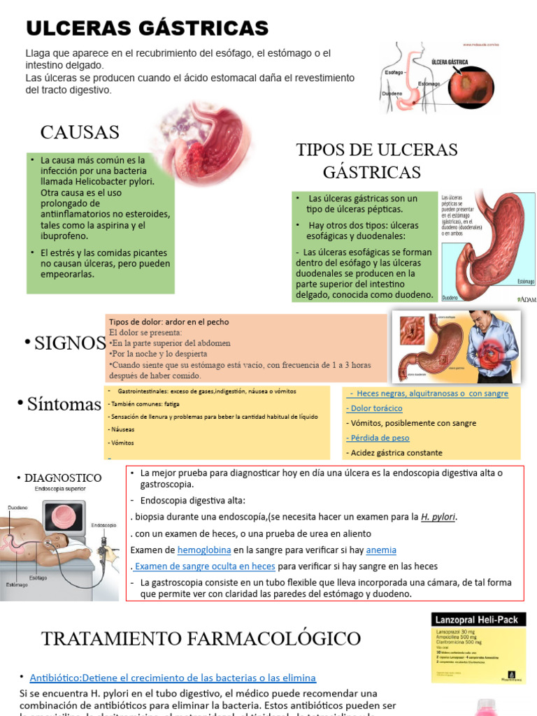 ULCERAS GÁSTRICAS kgm. | PDF | Gastroenterología | Medicina CLINICA