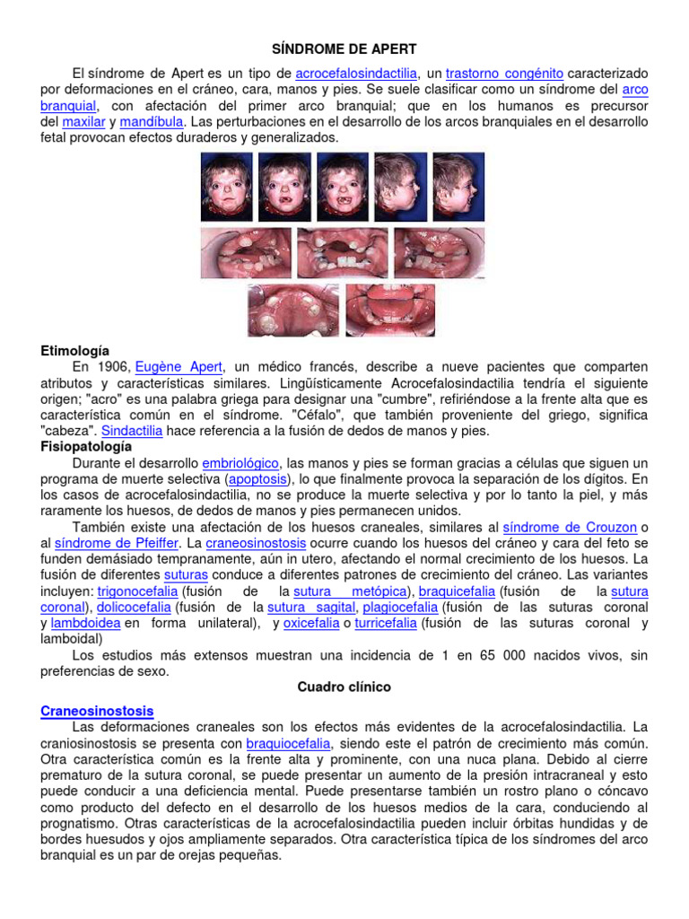 Síndrome de Apert | PDF | Especialidades Medicas | Enfermedades y ...