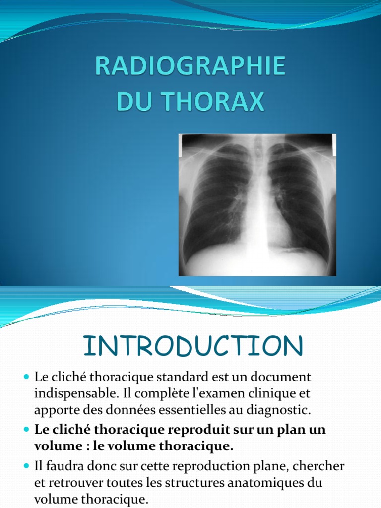 TD Radio Thorax Normale | PDF | Médecine | Anatomie humaine